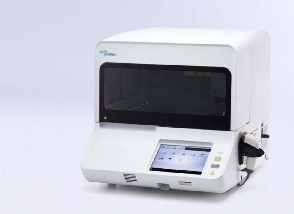 One Step Nucleic Acid (OSNA) intraoperative assessment of sentinel ...